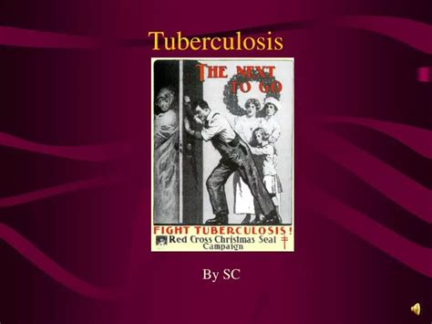 Ppt Tuberculosis Powerpoint Presentation Free Download Id 1467278