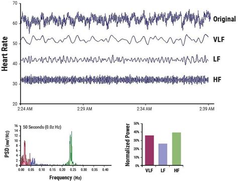 Healthy Heart Rate Variability Heart Rate Variability Analysis
