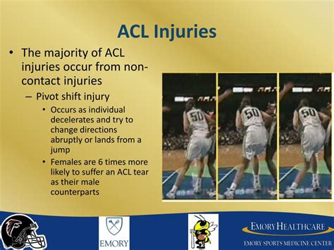 Ppt Acl Reconstruction The Anatomic Approach Powerpoint Presentation