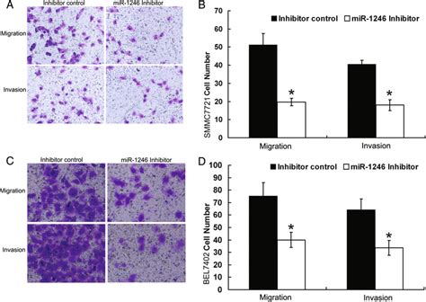 Inhibition Of Mir 1246 Reduced Migration And Invasion Of Smmc7721 And
