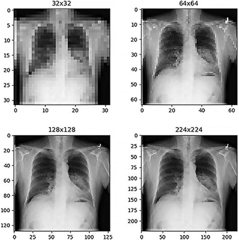 the effect of image resolution on deep learning in radiography