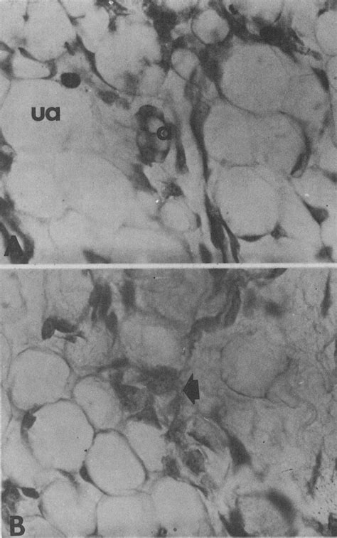A Cluster Of Immature Adipocytes A In Inguinal Adipose Tissue From A