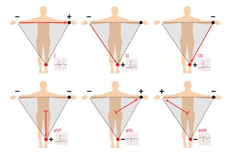 12 lead ecg placement 12 lead ecg placement med surg nursing