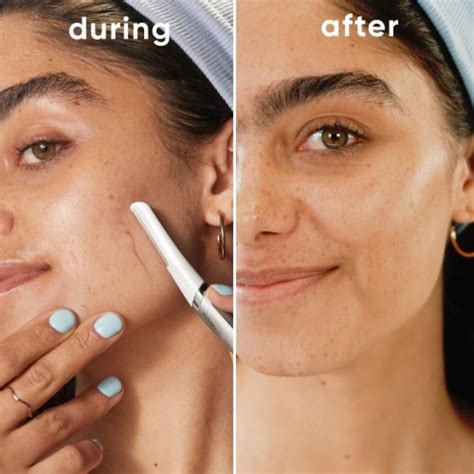 Gillette Venus For Facial Hair And Skin Dermaplaning Facial Razor Refill
