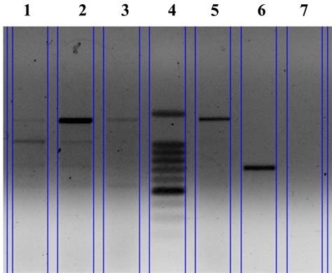 1 1 Agarose Gel Showing Typical Pcr Results Obtained For The
