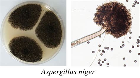 Aspergillus Morphology Clinical Features And Lab Diagnosis • Microbe