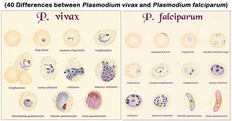 Plasmodium Falciparum Under Microscope