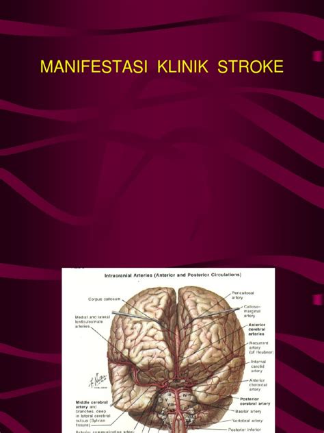 3 Manifestasi Klinik Stroke Pdf Stroke Thrombosis