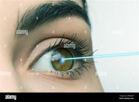 Closeup View Of Woman And Laser Ray Illustration Vision Correction