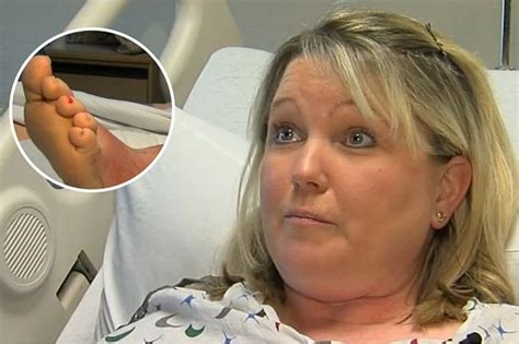 Womans Warning To Others After Pedicure Gave Her Nasty Infection That