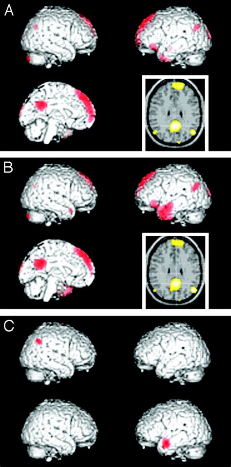 Parietal Cortex And Representation Of The Mental Self Pnas