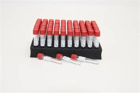 Tubo ácido Nucléico Viral Del Equipo 1ml De La Extracción De La Dna Del
