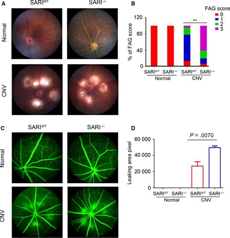Fundus And Fluorescence Imaging Of Laser‐induced Choroidal