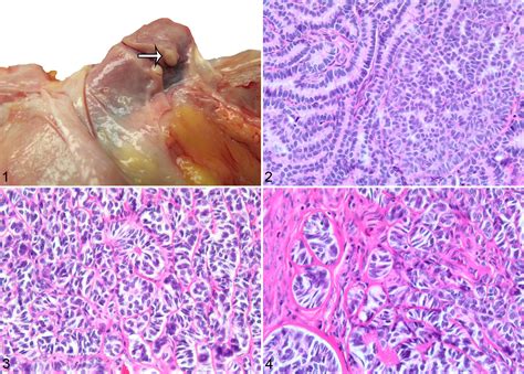 Uterine Tumors Resembling Ovarian Sex Cord Tumors In Four Baboons