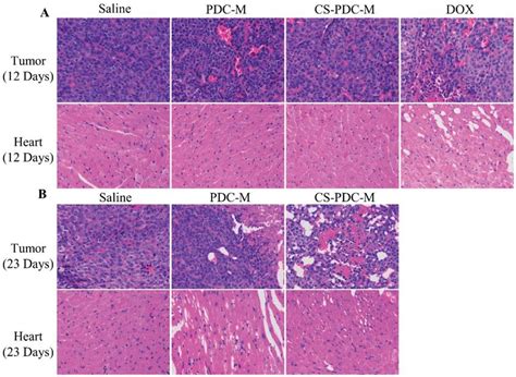 Hande Analyses Of Tumors And Hearts Of Nude Mice Bearing Hepg2 Cell