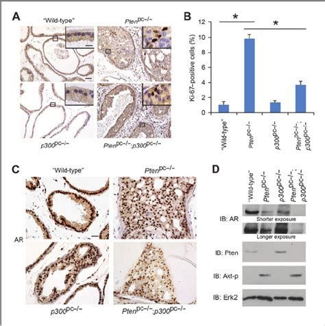 P300 Knockout Decreases Cell Proliferation And Ar Protein Levels In