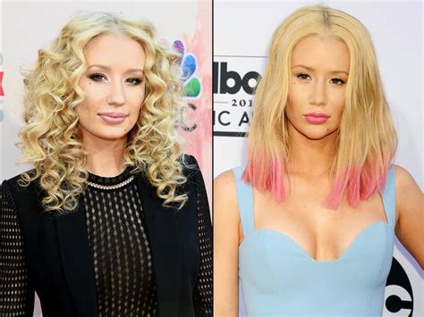 Iggy Azalea Got Plastic Surgery Nose Job Chin Implant Debut At Bbmas