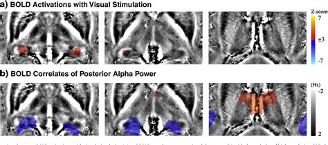 Figure 4 From Finding Thalamic Bold Correlates To Posterior Alpha Eeg