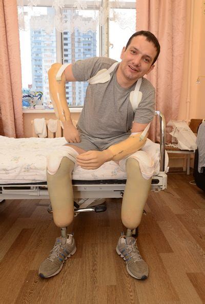 Life Goes On For Ukrainian Soldier Survivor Of Debaltseve Battle