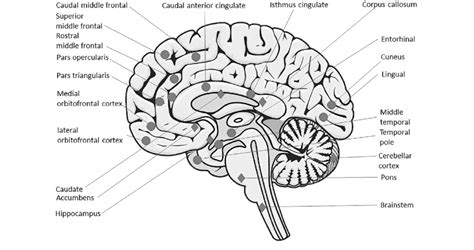 Depiction Of The Cortical And Subcortical Brain Areas