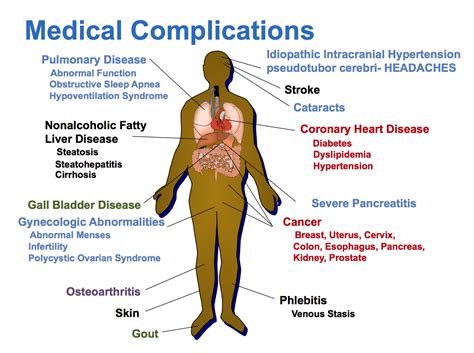 Excess Weight And Health Risks St Rita