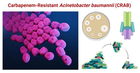 Carbapenem Resistant Acinetobacter Baumannii Crab Antimicrobial
