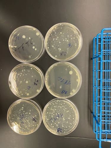 Lab 12 Enumeration Of Viable Bacteria Serial Dilution Method