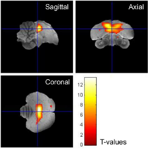 Example Of An Fmri Bold Response In The Primary Auditory Region Field
