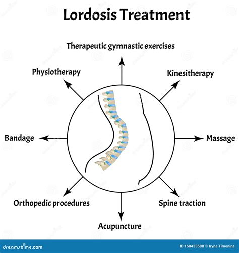 Lumbar Lordosis Treatment