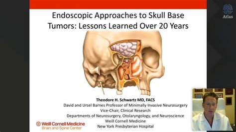 Endoscopic Skull Base Surgery Lessons Learned Grand Rounds Virtual
