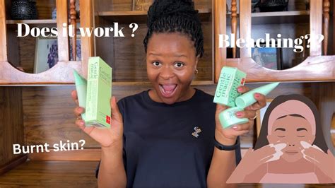 Gentle Magic Skincare Review How To Avoid Burn After Using Gentle