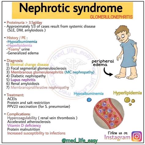Nephrotic Syndrome Medizzy