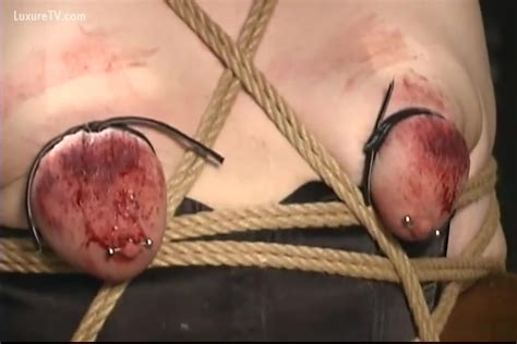extreme overbearing bleed an chubby woman out of anesthesia xxx femefun
