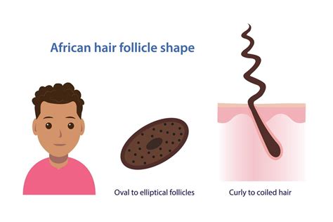 Infographic Of African Hair Follicle Shape Vector Illustration Isolated