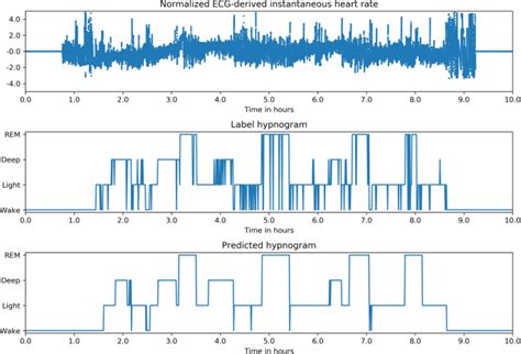 Deep Learning For Automated Sleep Staging Using Instantaneous Heart