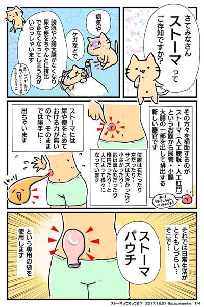 ストーマ（人工の肛門・膀胱）って知ってますか？ 実情と理解を広めるため使用者自ら描いた漫画が話題に ねとらぼ