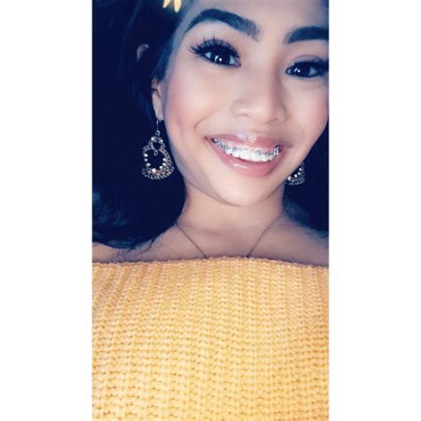 Got My Braces Tightened Today Getting Them Off In 3 Months 😁 R Braces