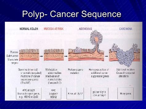 Neoplastic Colonic Polyp