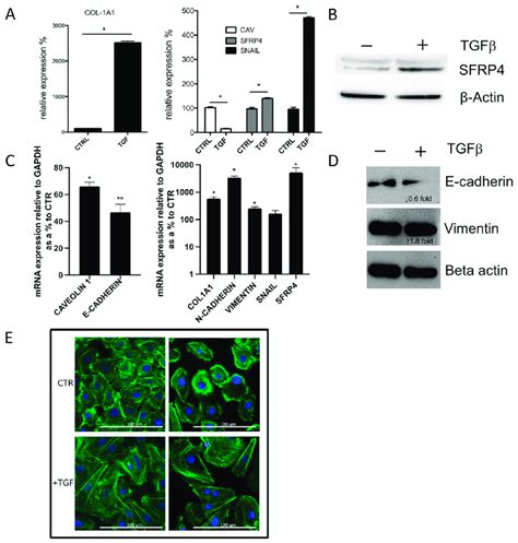 Sfrp4 Is Induced During In Vitro Tgf Driven Emt A Rt Pcr For