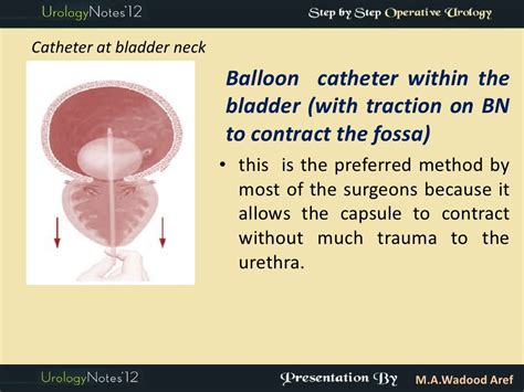 Turp Step By Step Operative Urology