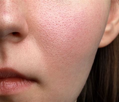 Cómo Identificar Tu Tipo De Piel Una Guía Completa Cosméticos Kaloe