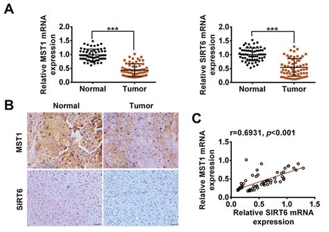 Down Regulation Of Mst1 In Glioma A The Mrna Expression Of Mst1 P