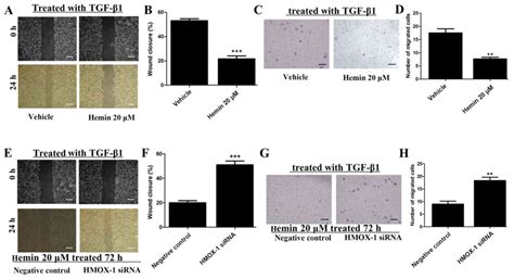 Hmox 1 Inhibits Tgf β Induced Epithelial Mesenchymal Transition In The