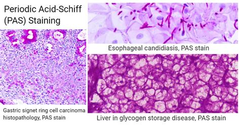 Periodic Acid Schiff Pas Staining