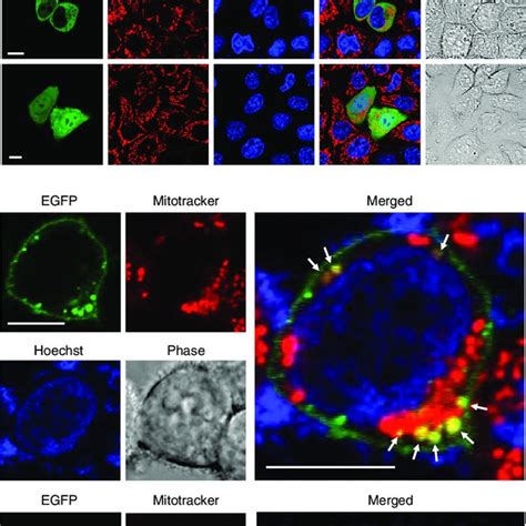 Gsdme Regulates Caspase 3 Activation And Pyroptosis In Cem C7 Cells A
