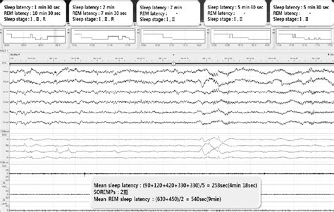 kathy howard info sleep latency test
