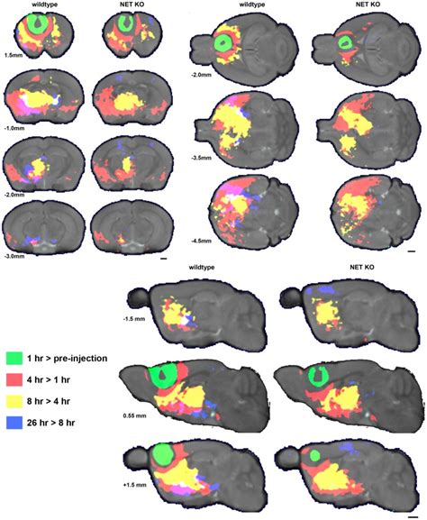 Representative Sections Through The Statistical Parametric Maps Show