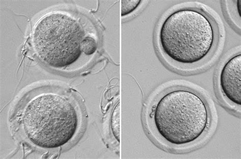 Fig 3 [image] Eurekalert Science News Releases