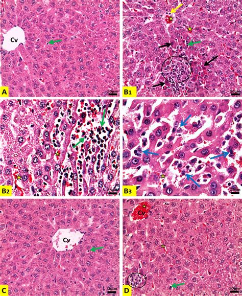 Representative Photomicrographs Of Histopathological Alterations In