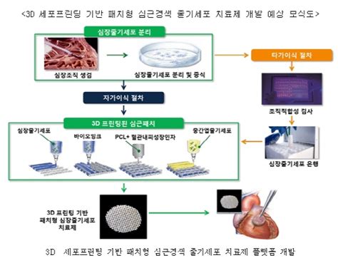 서울성모병원 3d 프린팅 줄기세포 치료 개발